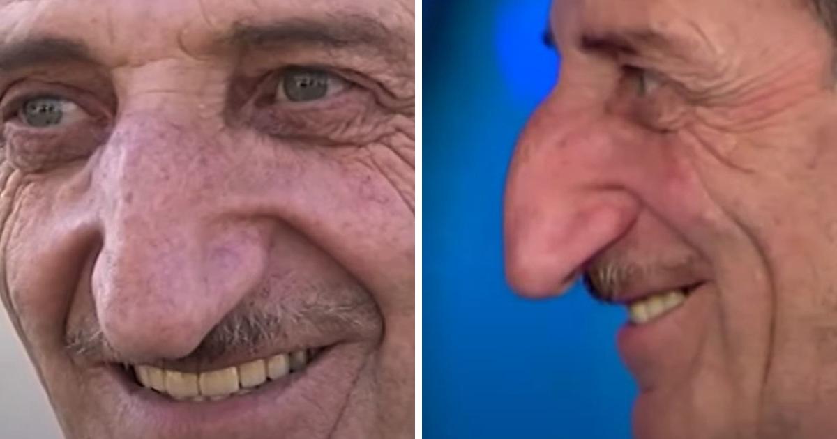Man 71 Holds Record For World s Longest Nose And It s Only Getting Bigger